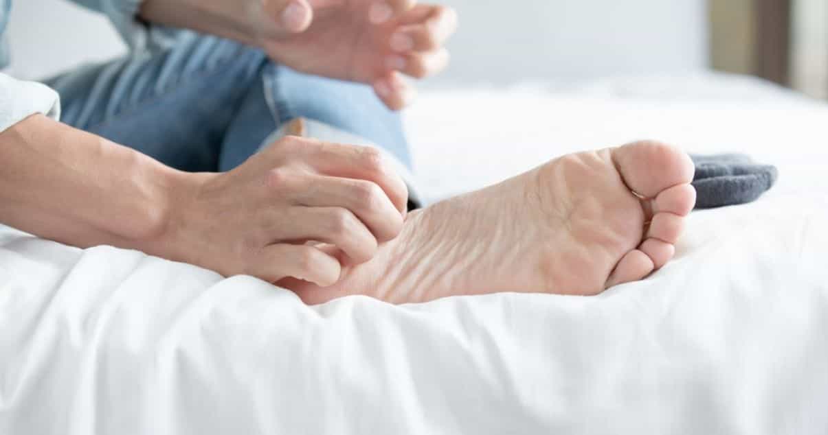 What if Athlete's Foot Won't Go Away?